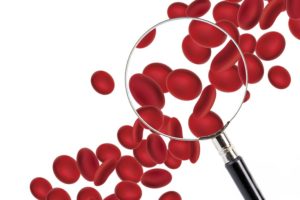 Anémies : Définition, symptômes, causes et traitement